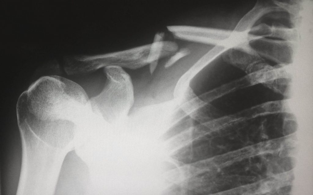 FEDRIS : comment déclarer votre accident de travail